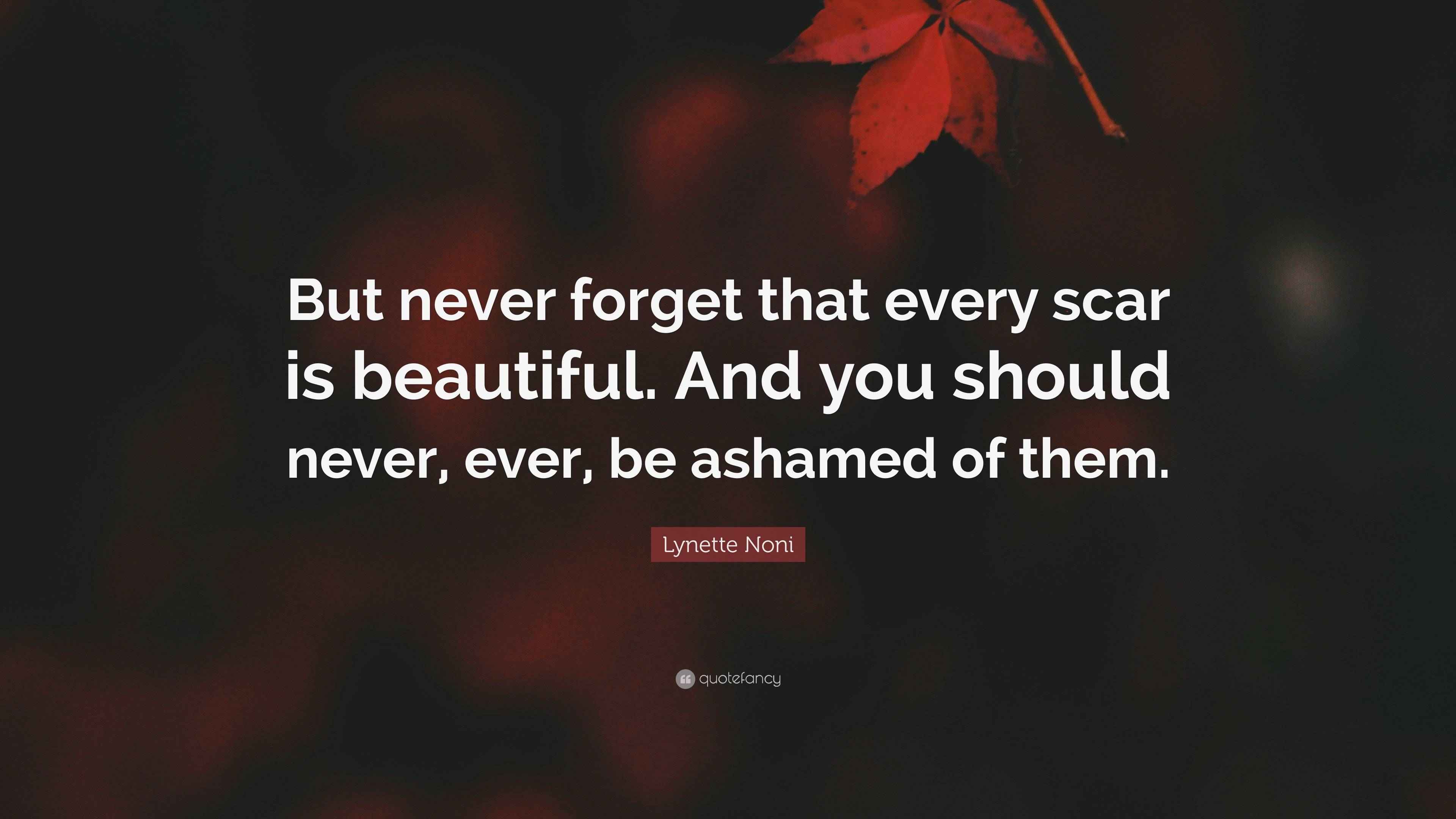 Lynette Noni Quote: “But never forget that every scar is beautiful. And ...