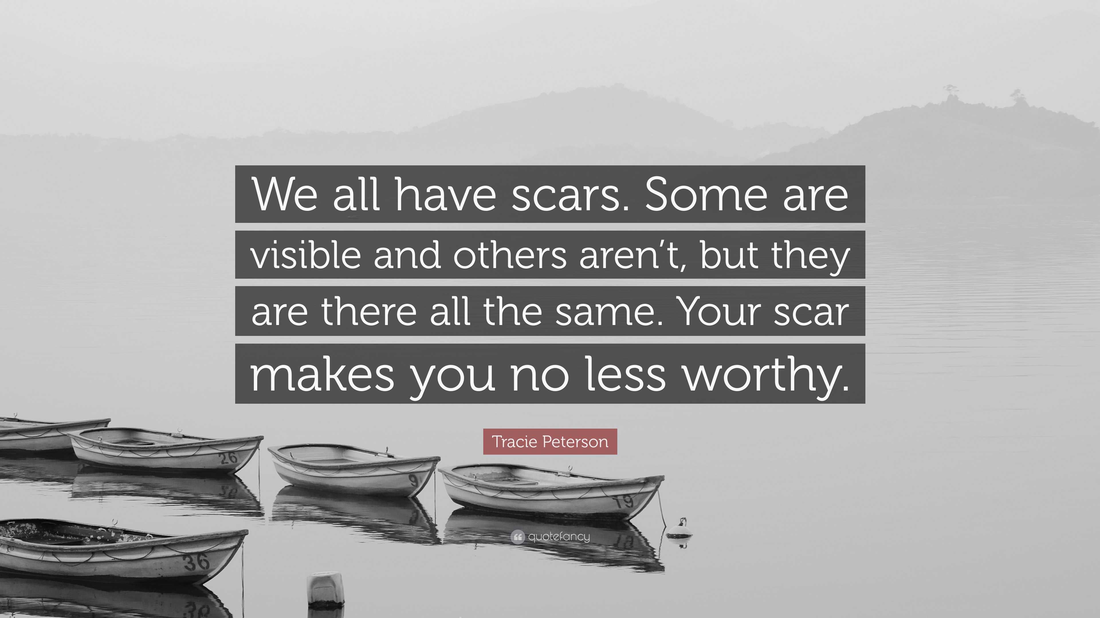 Tracie Peterson Quote: “We all have scars. Some are visible and others ...